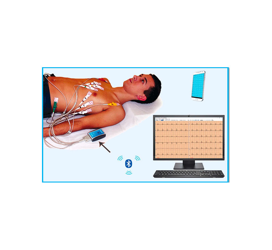 ECG-PC EOLYS - ECG de repos connecté PC - 12 pistes